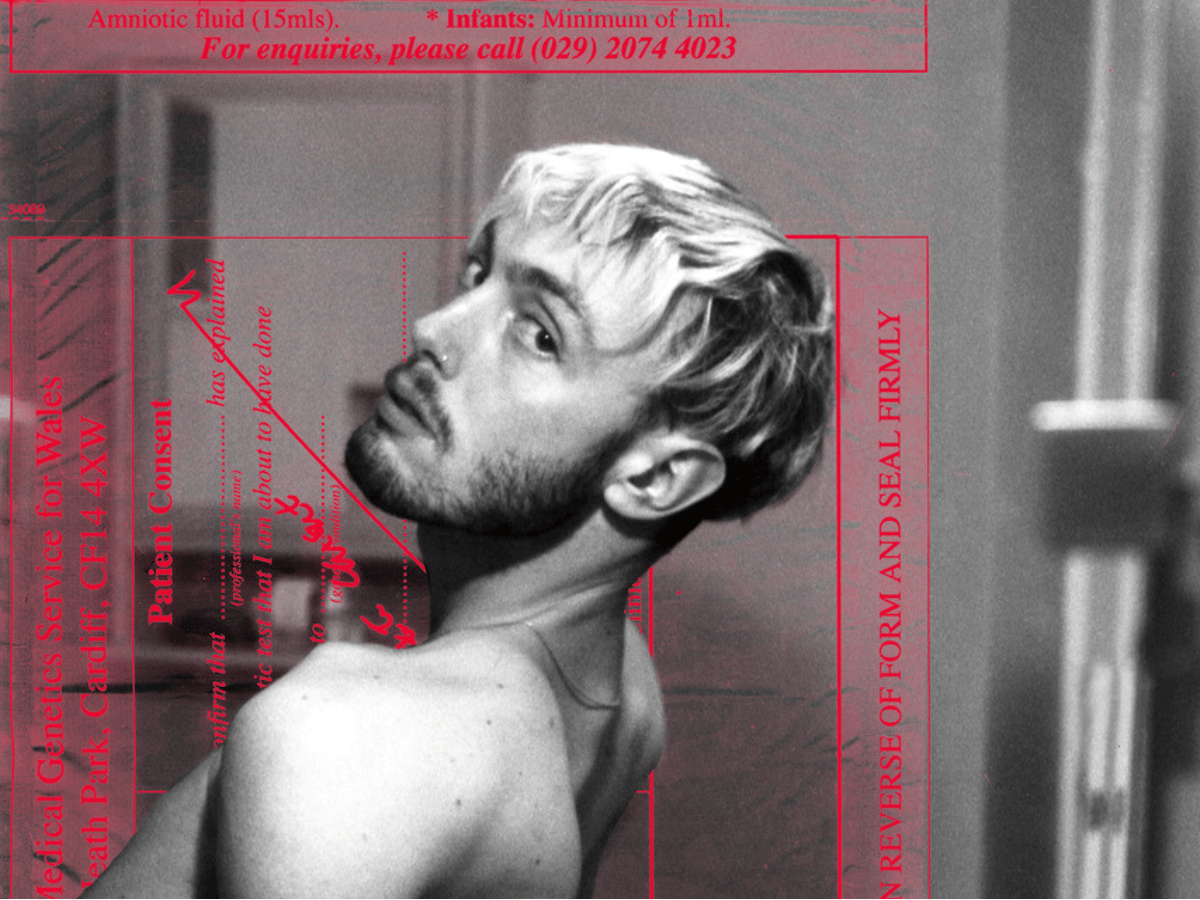 Swansea photographer Jack Moyse: muscular dystrophy in art